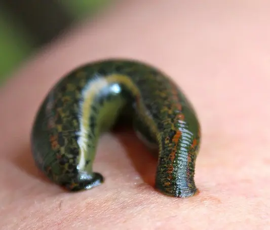 Hirudoterapie Bucuresti • Terapie cu lipitori - Clinica Ta Saiwala